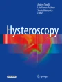 Hysteroscopy | SpringerLink