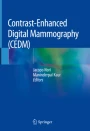 Contrast-Enhanced Digital Mammography (CEDM) | SpringerLink