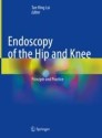 Arthroscopic Anatomy of the Hip | SpringerLink