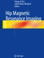 Osteonecrosis of the Hip | Springer Nature Link (formerly SpringerLink)