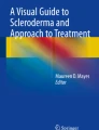 Cutaneous Manifestations of Scleroderma and Scleroderma-Like Disorders ...