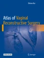 Diagnosis and management of vaginal mullerian cyst in a virgin patient ...