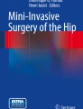 Prospective and comparative study of the anterolateral mini-invasive ...