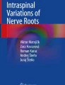 Lumbosacral Conjoined Nerve Roots | Springer Nature Link (formerly ...
