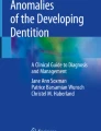 Conditions Associated with Premature Exfoliation of Primary Teeth or ...