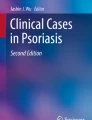 Antineoplastic Therapy—Induced Palmar Plantar Erythrodysesthesia (‘Hand ...