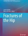 Pipkin fractures: fracture type-specific management | Archives of ...