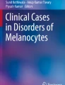 Addison’s disease without hyperpigmentation in pediatrics: pointing ...