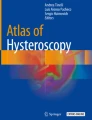 Histology and Hysteroscopic View of Normal Endometrium | SpringerLink