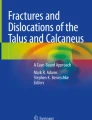 Talus bone: normal anatomy, anatomical variations and clinical ...
