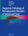 Small B-cell lymphomas of the spleen: how to tell them apart | Journal ...