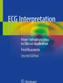 ECG of Pacemakers | Springer Nature Link