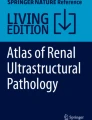 Histopathology of Glomerular Diseases | SpringerLink