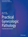 Pathology of the Fallopian Tube | Springer Nature Link (formerly ...