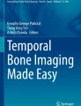 Temporal Bone Fractures | SpringerLink