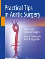 Valve Sparing Aortic Root Procedure: Yacoub’s Procedure | SpringerLink