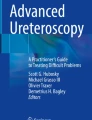 How to Perform Semi-rigid Ureteroscopy: Step by Step | SpringerLink