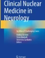 Optic Nerve Sheath Meningioma | Springer Nature Link