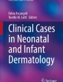 Acrodermatitis Enteropathica: A Clinician's Guide | Springer Nature ...