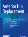 Posterior approaches to the acetabulum | Archives of Orthopaedic and ...