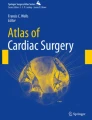 Valve Sparing Aortic Root Procedure: Yacoub’s Procedure | SpringerLink
