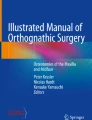 Segmental Osteotomy for the Maxilla | SpringerLink