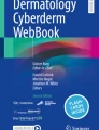 Dermatological Manifestations in Fabry Disease | SpringerLink