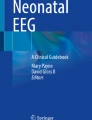 Developmental Changes in EEG Patterns: Development of Tracé Alternant ...