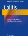 Segmental Colitis Associated with Diverticulosis | SpringerLink