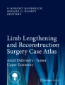 Below-Knee Amputation Stump Lengthening | SpringerLink