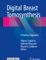 Digital Breast Tomosynthesis | SpringerLink