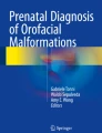 Antenatal Diagnosis of Bilateral Proximal Femoral Focal Deficiency ...