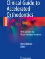 Regional Acceleratory Phenomenon in Surgically Facilitated Orthodontic Therapies | SpringerLink