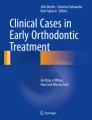 Early Treatment of Class III Malocclusions | SpringerLink