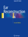 Antia-Buch Procedure (Chondrocutaneous Advancement Flap) | SpringerLink