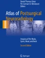 Gross Anatomy and Development of the Temporal Bone Relevant to Imaging ...