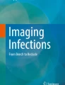 Optical imaging of bacterial infections | Clinical and Translational ...