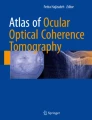 Anterior Segment Optical Coherence Tomography (AS-OCT) | SpringerLink