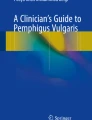 Pemphigus Vegetans | SpringerLink