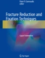 How Fractures Are Described: By the Direction of the Fracture Line ...