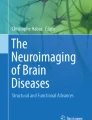 A focus on the normal-appearing white and gray matter within the ...