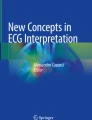 ECG Interpretation of Wide QRS Complex Tachycardia : A collection of 50 ...