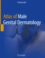 Melanotic Macules | Springer Nature Link