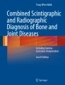 The EANM practice guidelines for bone scintigraphy | European Journal ...