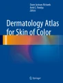 Chronic Actinic Dermatitis: a Review | Current Dermatology Reports