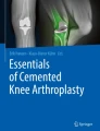 Antibiotic-loaded cement in total joint arthroplasty: a comprehensive ...