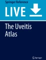 Idiopathic retinal vasculitis, aneurysms, and neuroretinitis (IRVAN ...