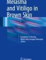 Update on Melasma—Part I: Pathogenesis | Dermatology and Therapy ...