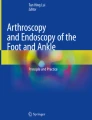 Transphalangeal Toe Amputation | SpringerLink