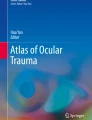 Conjunctival Lacerations and Injuries | Springer Nature Link